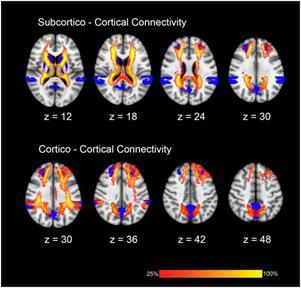Understanding brain damage in vegetative state patients - University of ...