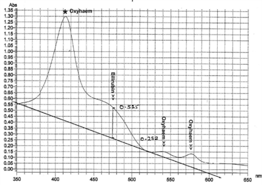 Spectrophotometry Of Cerebrospinal Fluid (CSF) - University of Birmingham