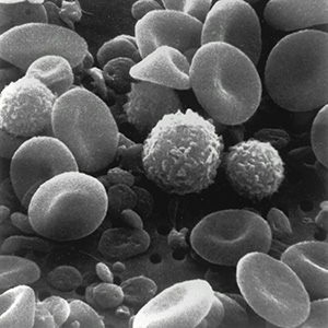 A day in the life: Blood cancer research