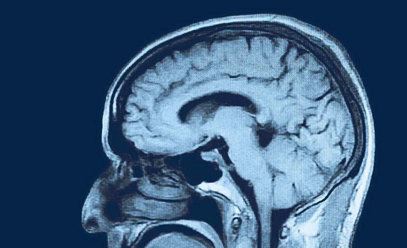Youth behavioural problems and brain differences - University of Birmingham
