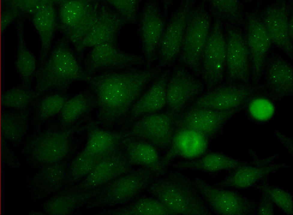 ANA Quiz - University of Birmingham