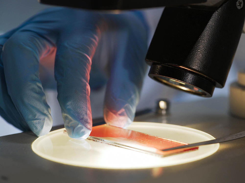 About platelets - University of Birmingham