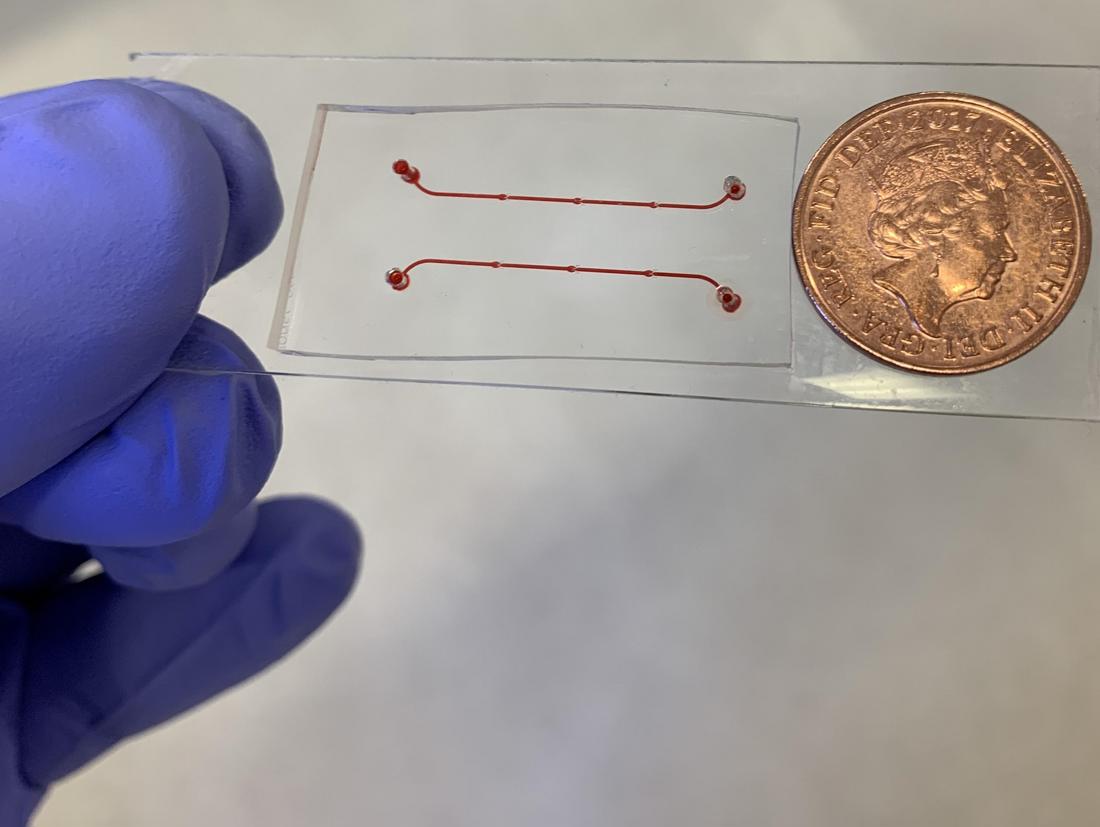 ‘Vein-on-a-chip’ could help scientists study thrombosis without animal ...