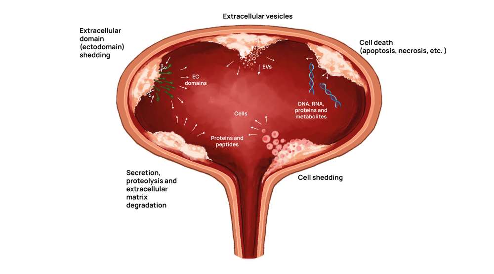 Pioneering test to detect bladder cancer based on DNA - University of ...