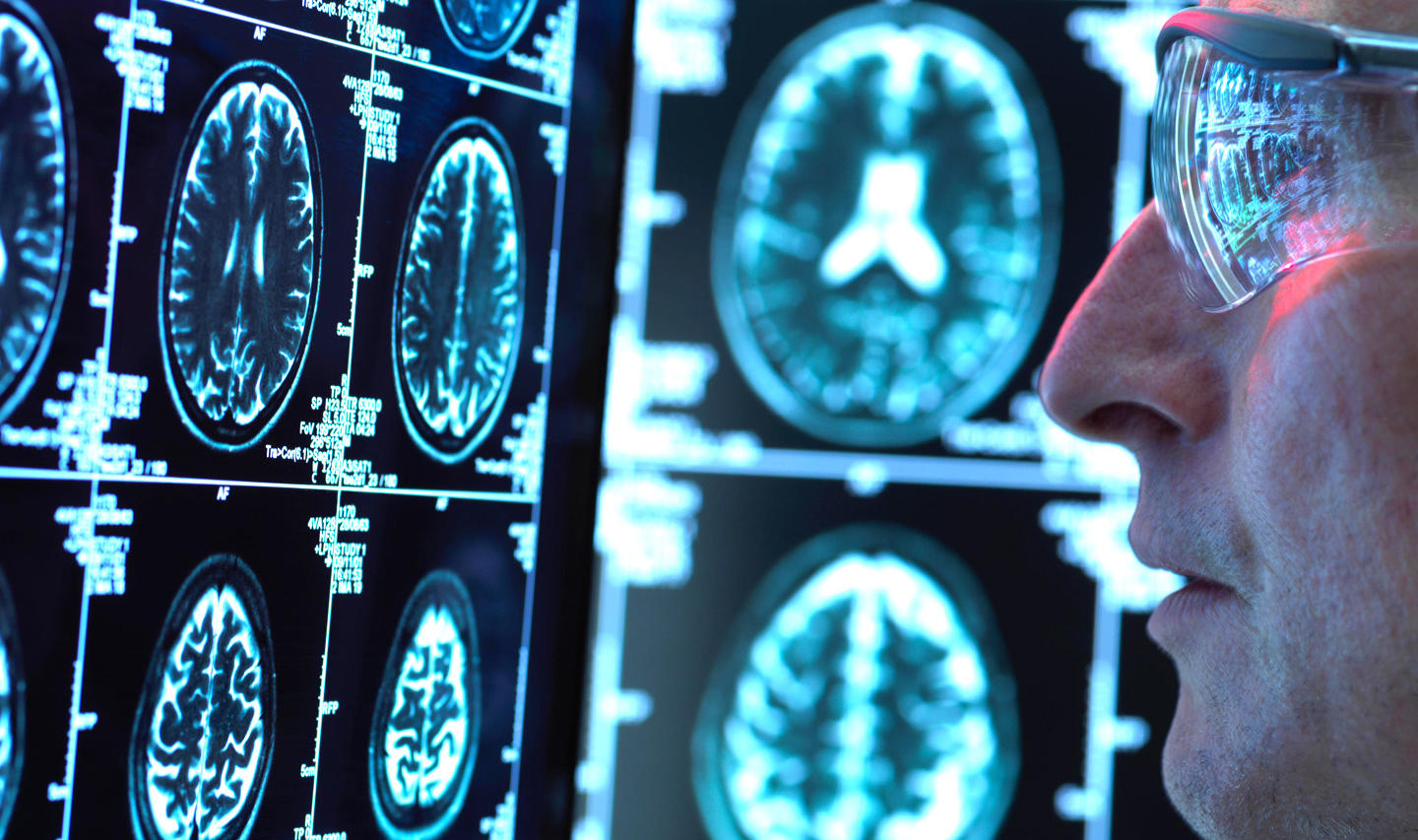 Focal brain damage leaves people more open to being influenced by ...