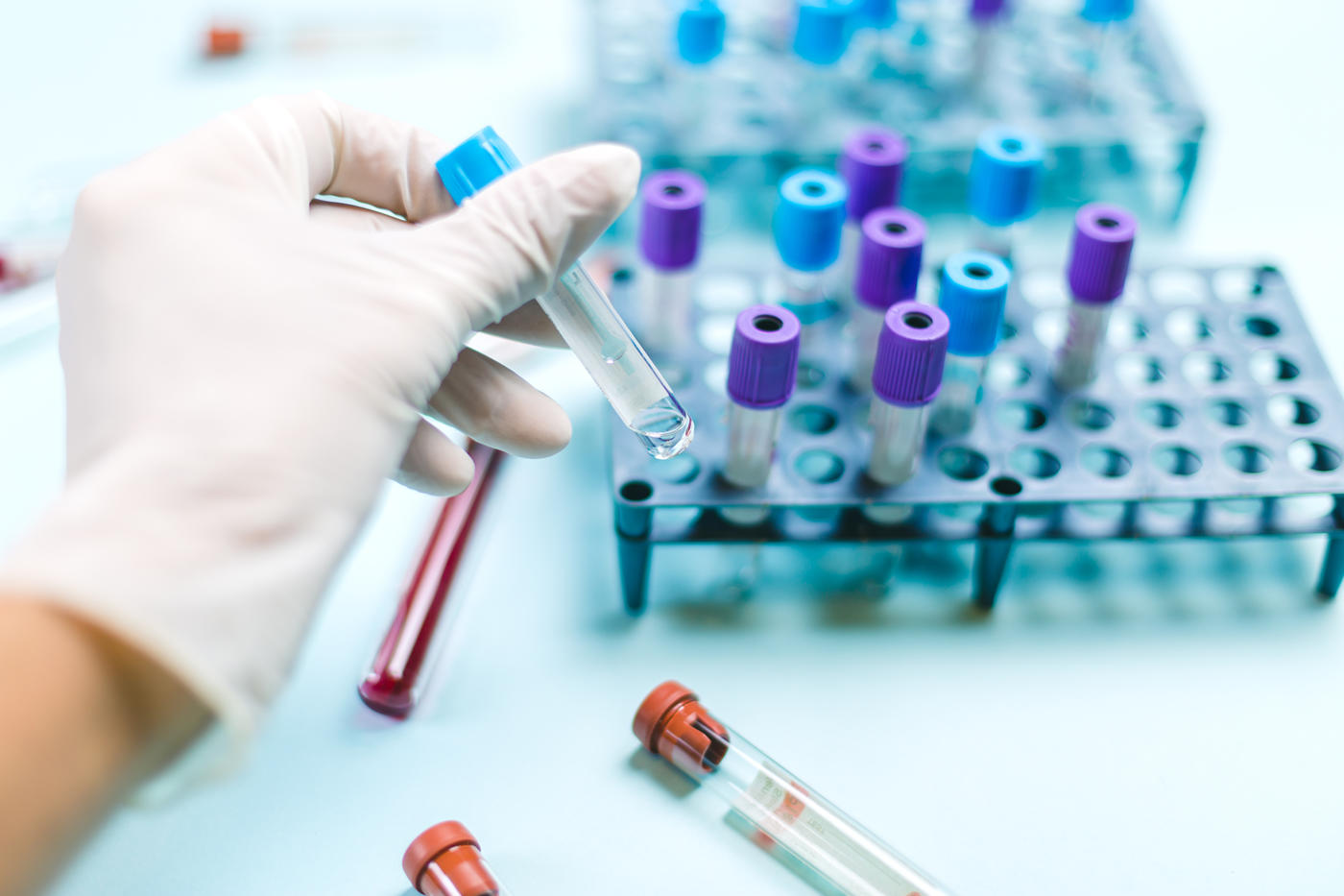 How the Birmingham Drug Discovery Hub created an investment-ready ‘drug ...